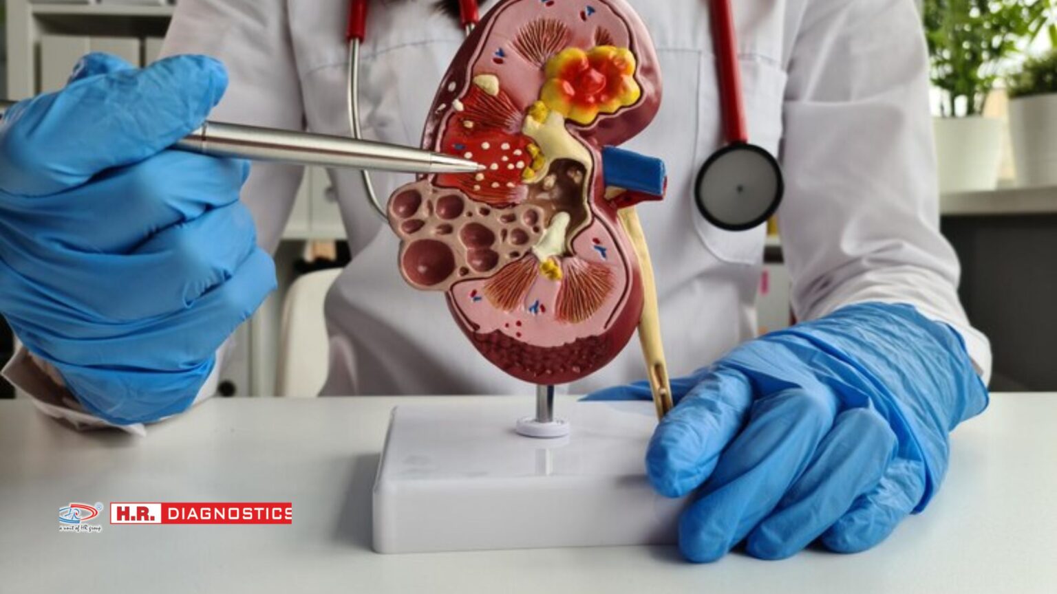 Kidney Function Tests | Urine Tests