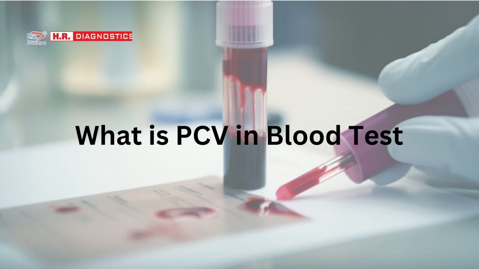 What is PCV in Blood Test | PDW Blood Test - HR Diagnostic
