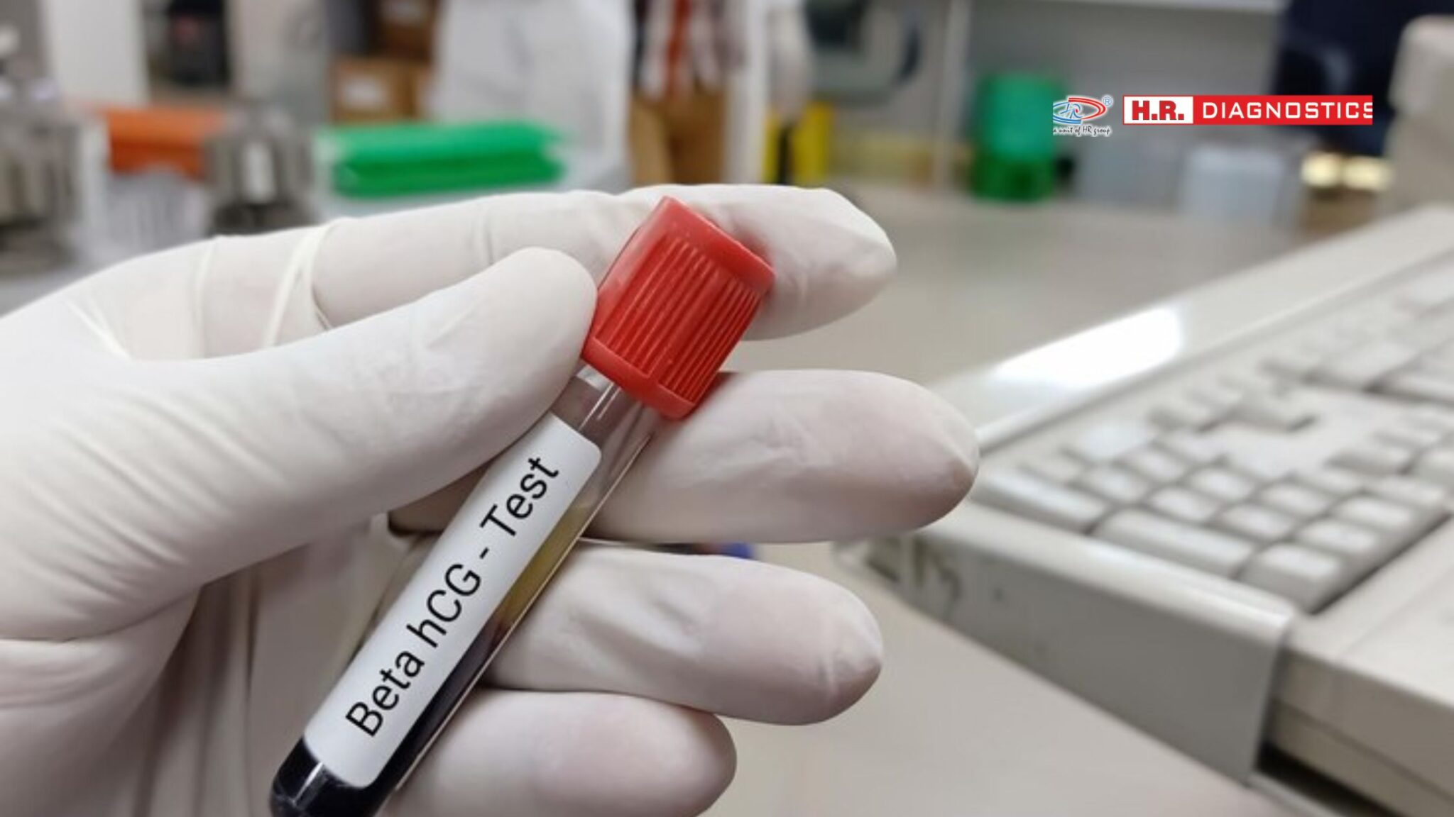 Comprehensive Guide to Beta HCG Test - HR Diagnostic Comprehensive Guide to Beta HCG Test - HR Diagnostic
