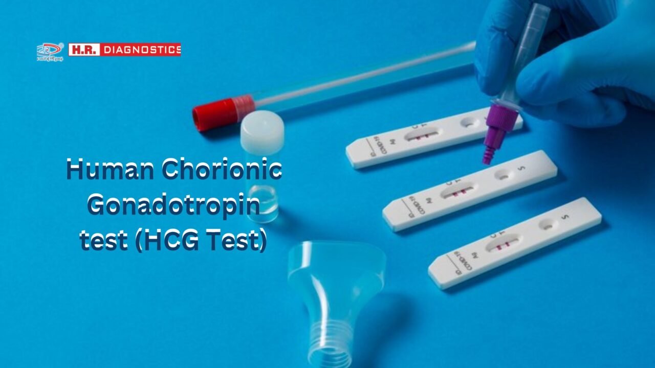 HCG Level Test: Understanding the Importance & Procedure - HR Diagnostic