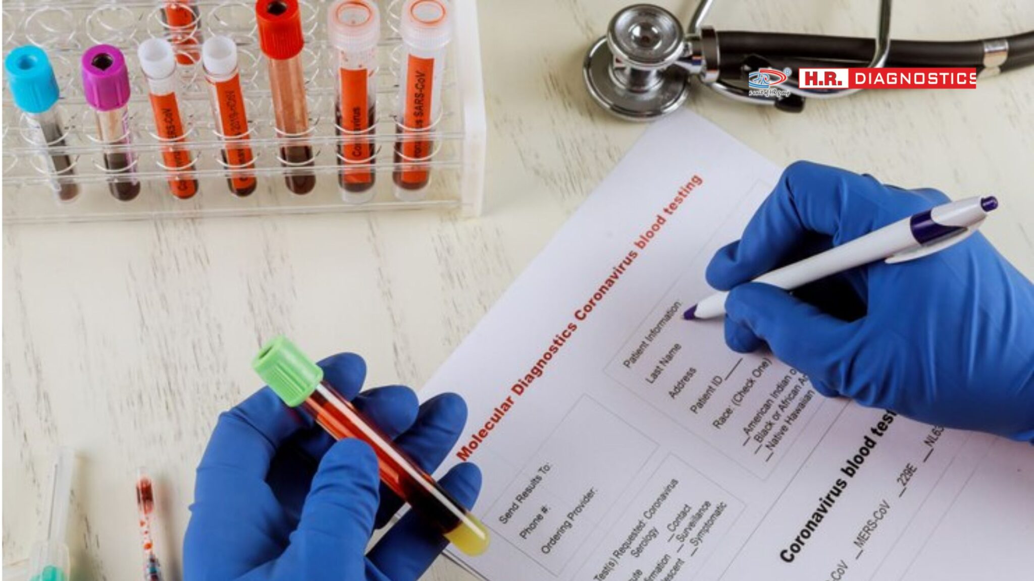 Human Chorionic Gonadotropin Test - HR Diagnostic