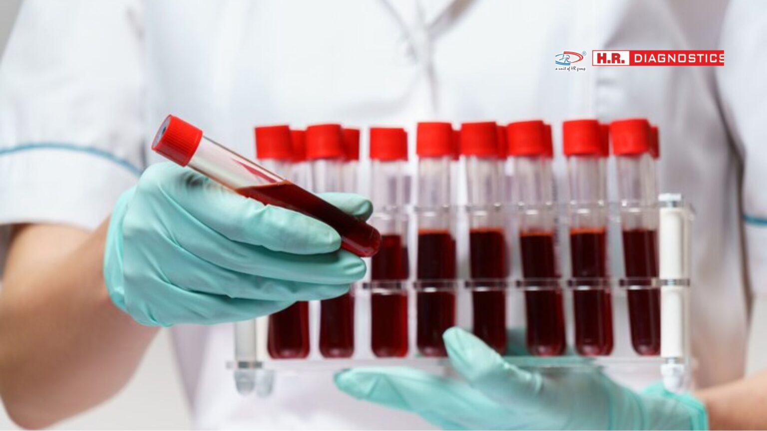 What is PCV in Blood Test | PDW Blood Test - HR Diagnostic