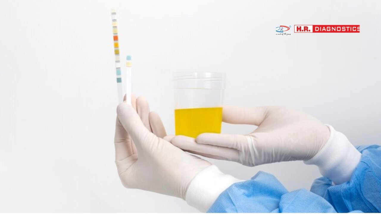 Urine Analysis: Guide for Accurate Health Diagnosis - HR Diagnostic Urine Analysis: Guide for Accurate Health Diagnosis - HR Diagnostic