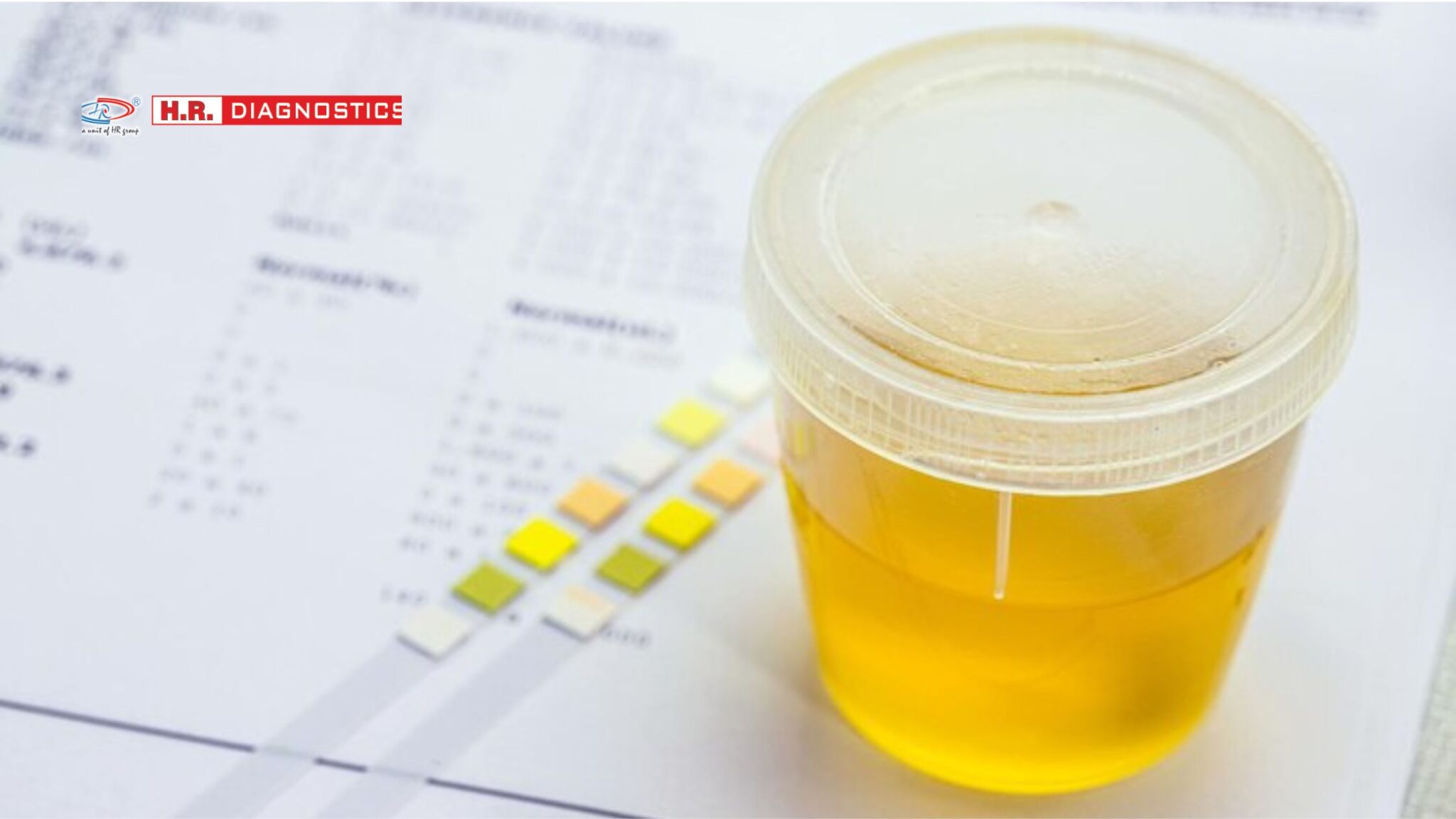 Complete Urine Examination for Health Monitoring - HR Diagnostic